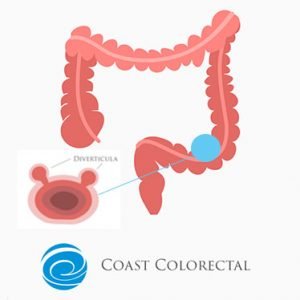 Professional Colorectal Surgeons in the Gold Coast and Tweed ...